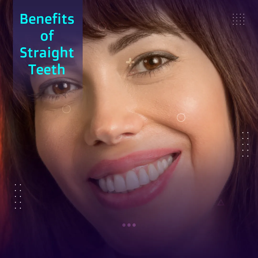 Benefits of Straight Teeth: Smile Confidently – Find Out How!