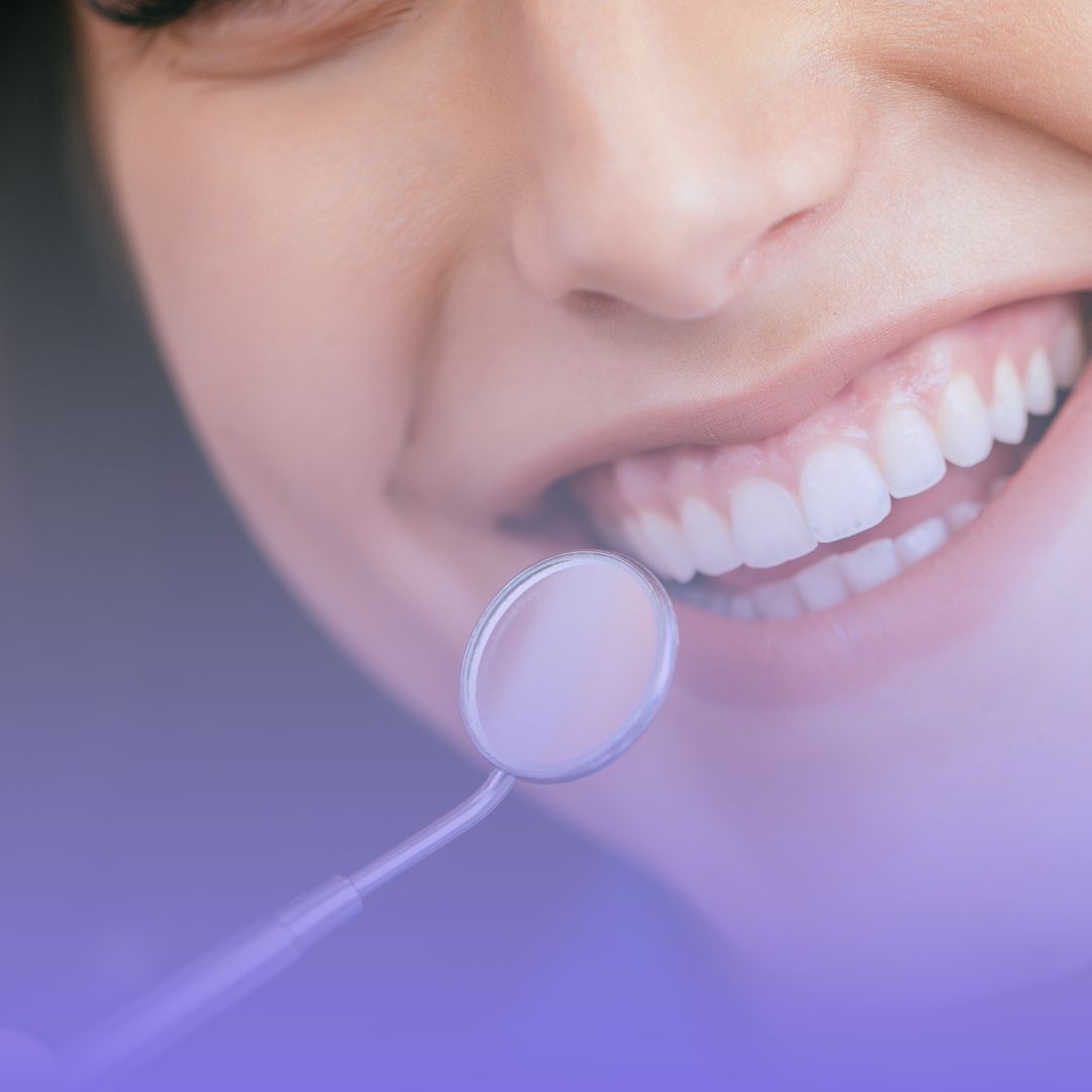 Benefits of Straight Teeth: Smile Confidently – Find Out How!